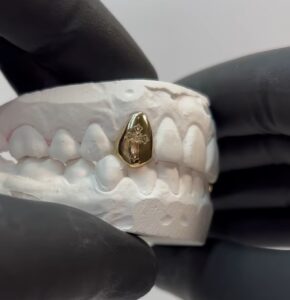 Nuovi gioielli per Damiano dei Maneskin: 2 denti d'oro con un'incisione ...